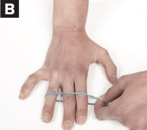 Collateral Ligament Sprain - The Climbing Doctor