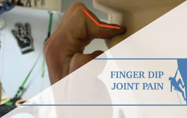 Clinical Management of Finger Joint Capsulitis/Synovitis in a Rock ...