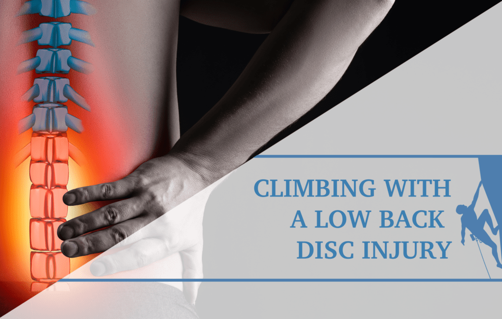 Climbing with discus hernia - The Climbing Doctor